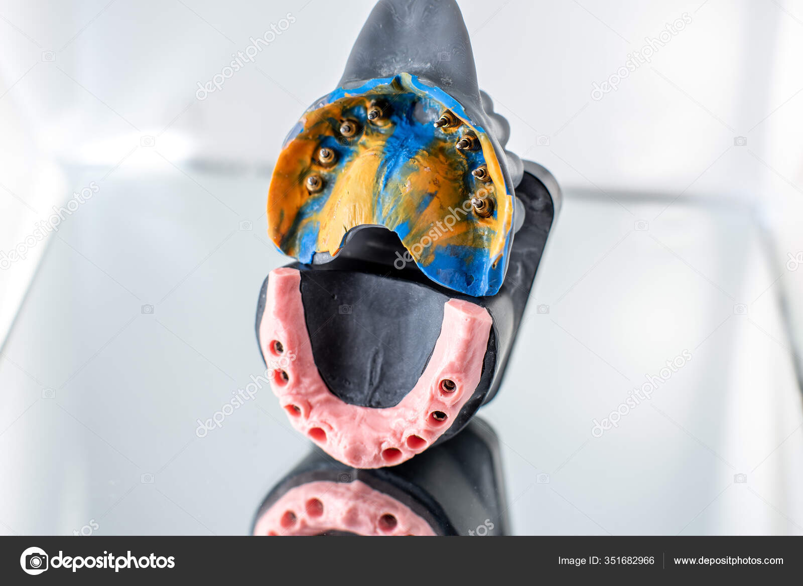 Jaw impressions for implants modeling ⬇ Stock Photo, Image by ...