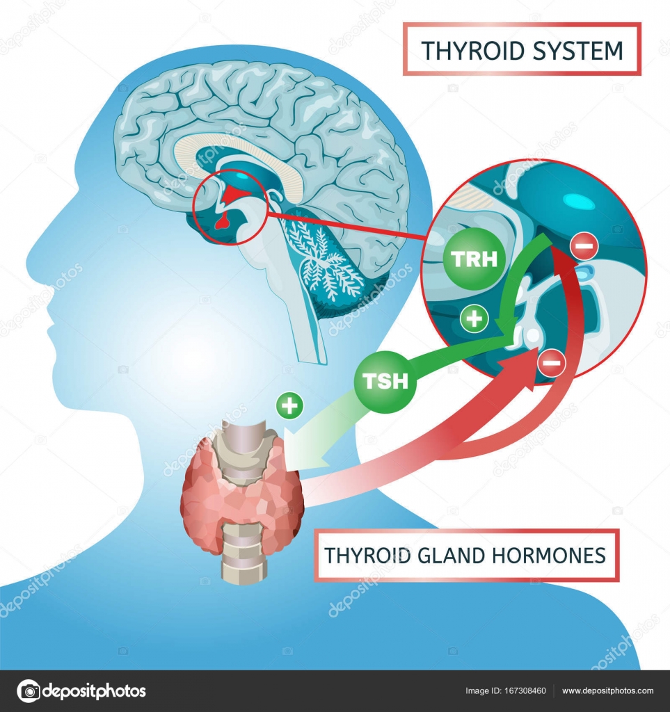 Tranchea, Imagen, Acción, Infografía Médica, Ilustración Vectorial ...