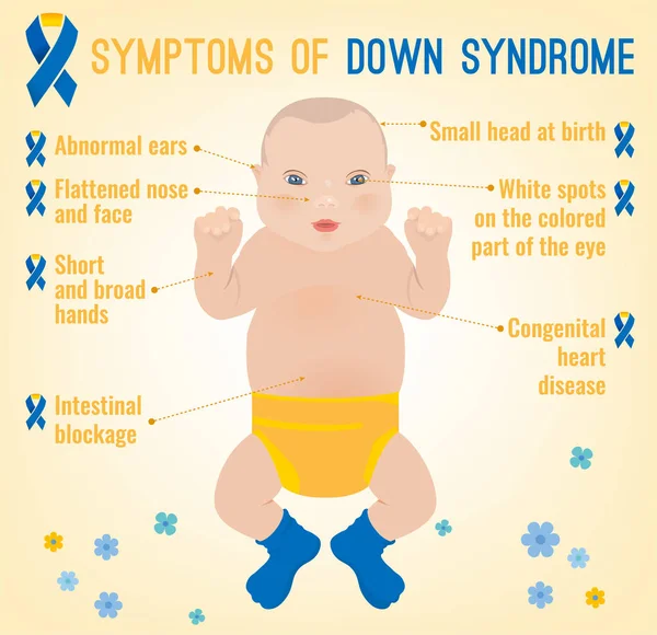 Down syndroom symptomen vectorafbeelding door © annyart ⬇ Vectorstock ...