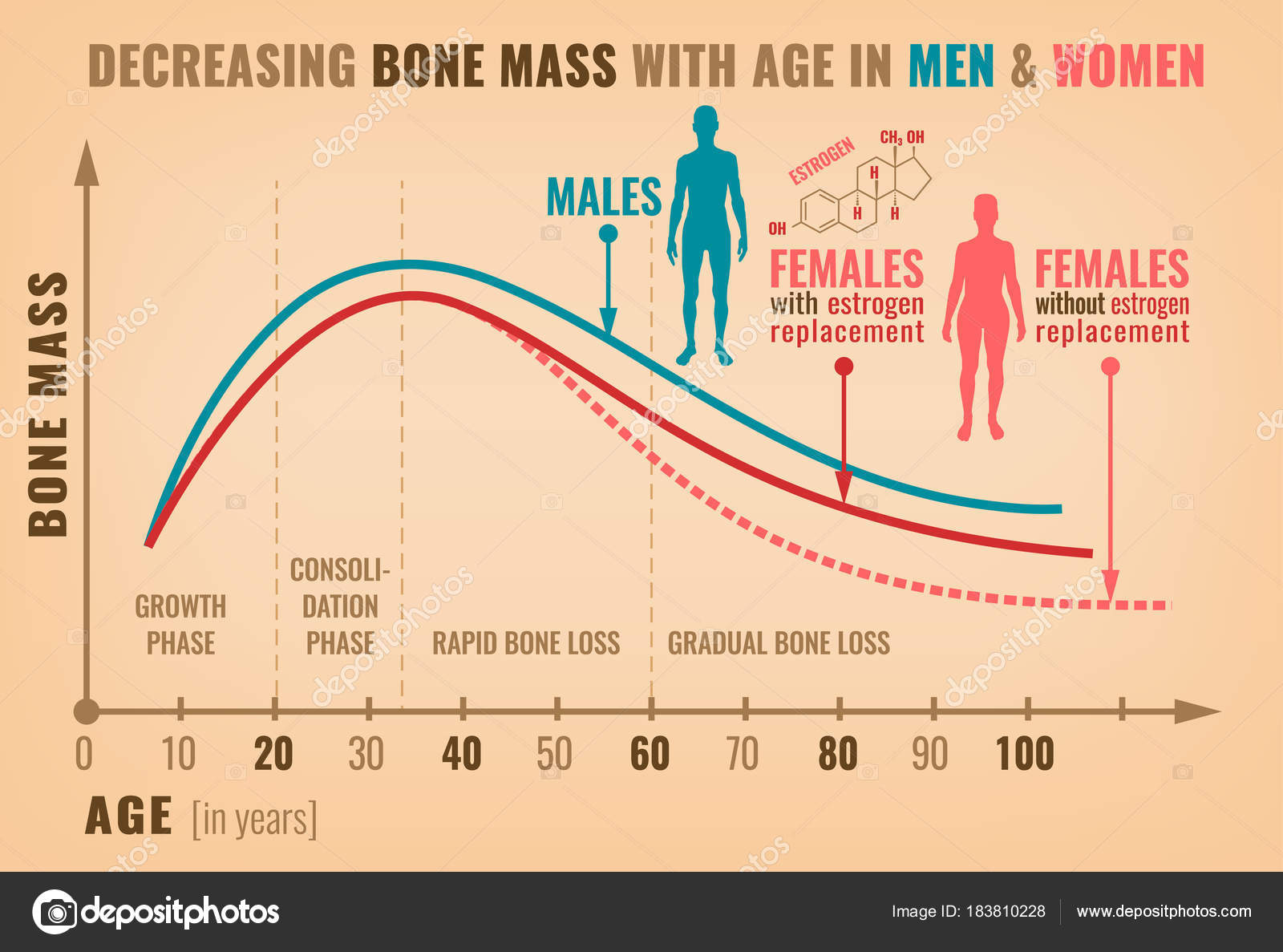 Decreasing bone mass Stock Vector Image by ©annyart #183810228 Decreasing bone mass Stock Vector Image by ©annyart #183810228