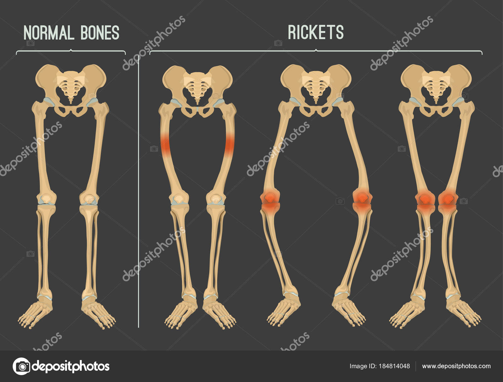 Vector Rickets Scheme — Stock Vector © annyart #184814048