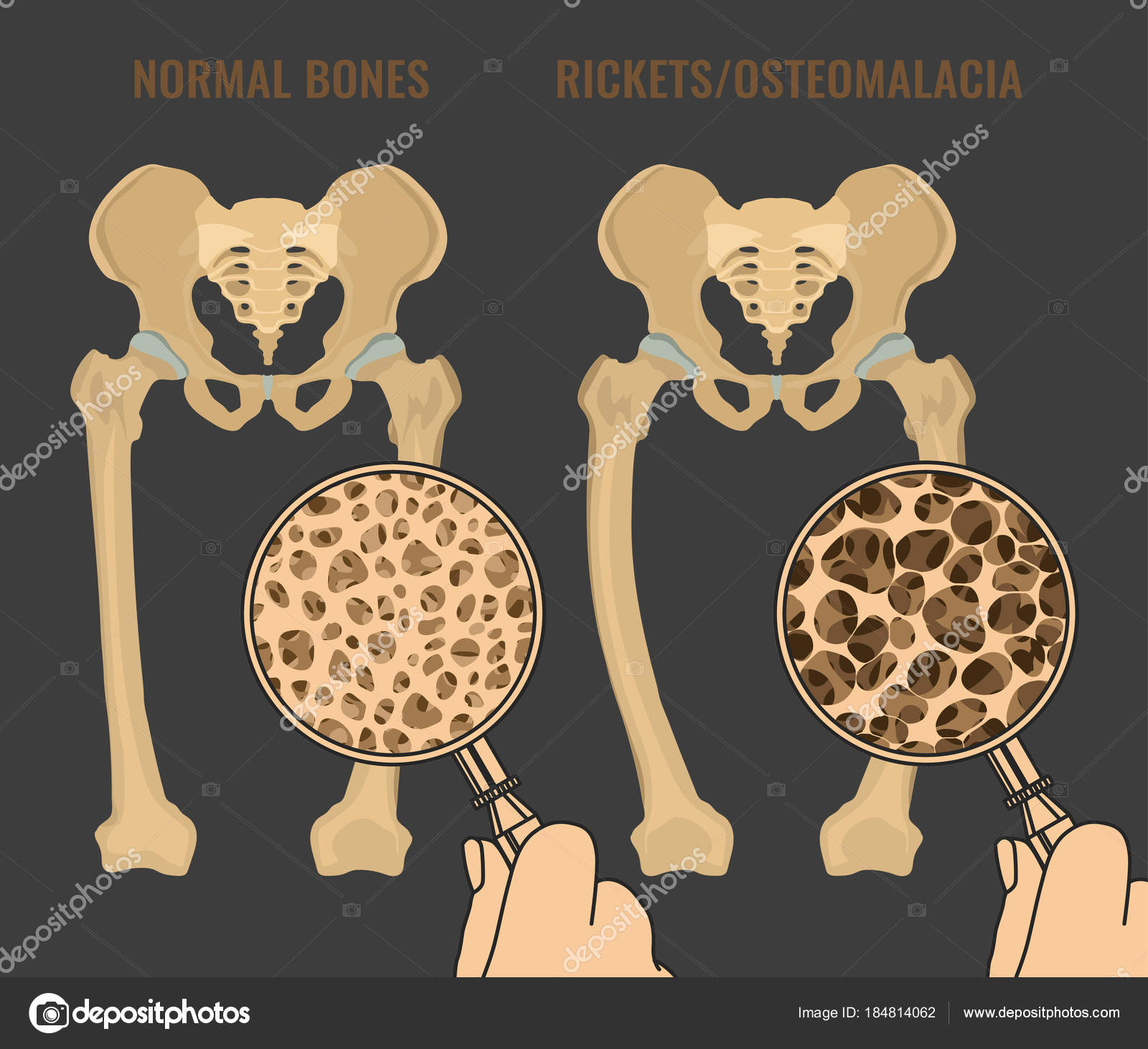 Vector Rickets Scheme Stock Vector by ©annyart 184814062