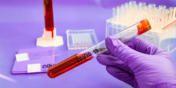 Coronavirus Blood Sample Dna Testing Blood Laboratory Blood Sample ...