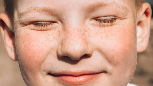 Niño con pecas fotos de stock, imágenes de Niño con pecas sin royalties ...