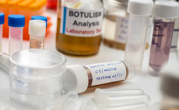 Biological samples Stock Photos, Royalty Free Biological samples Images ...