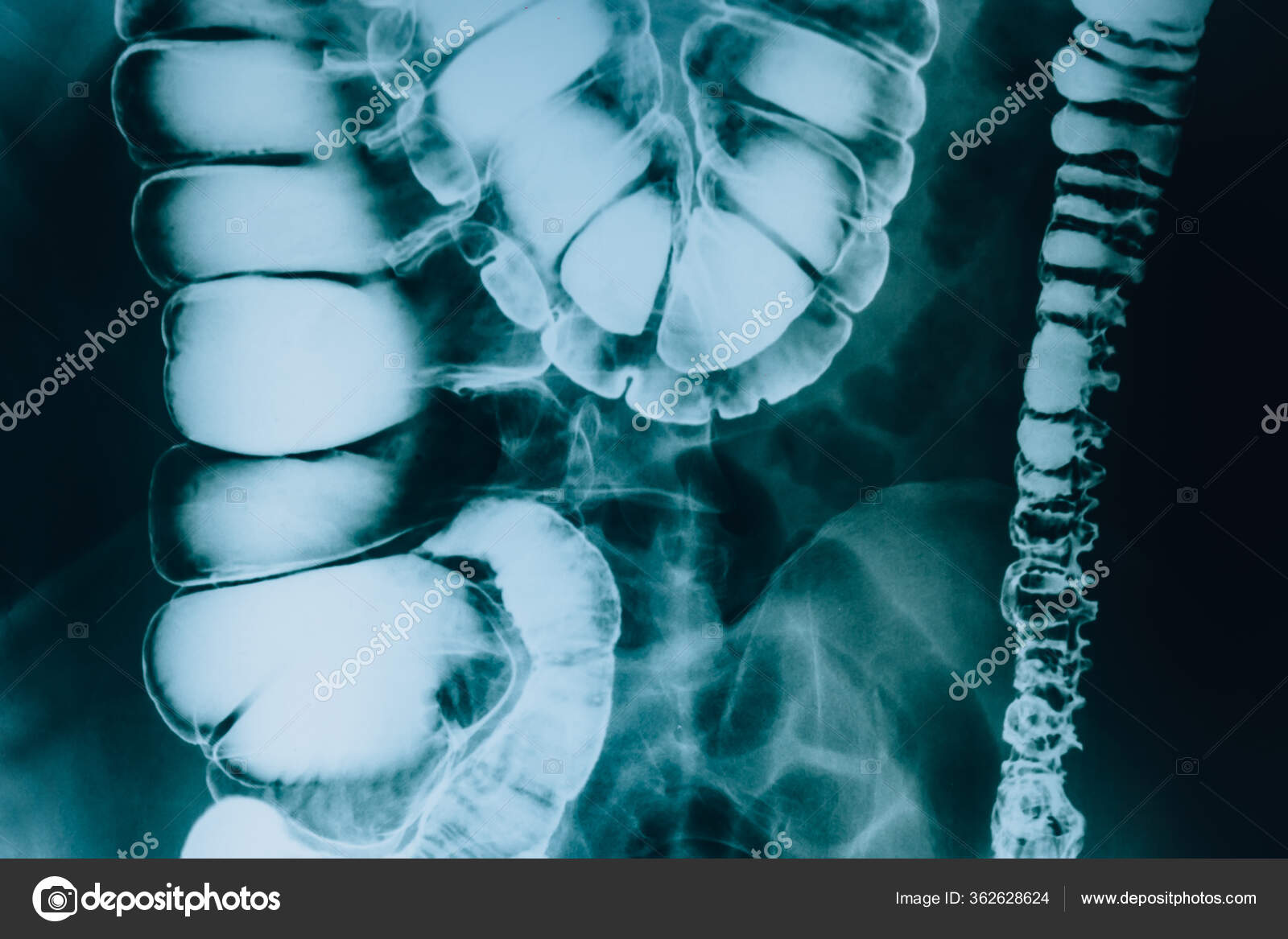 Ray Intestine Ray Snapshot Internal Organs Digestive System Doctors ...