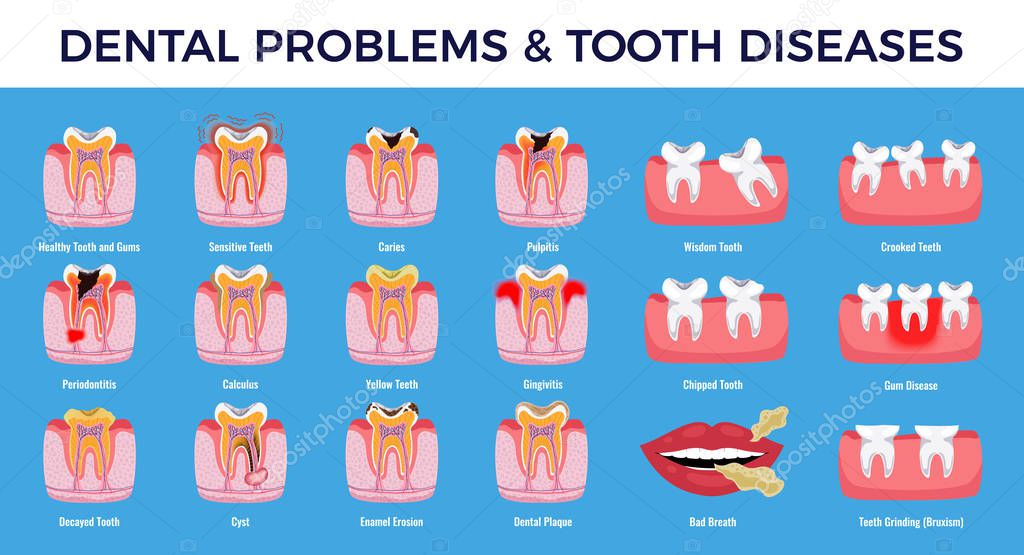 Conjunto Infográfico de Enfermedades de Problemas Dentales 2024