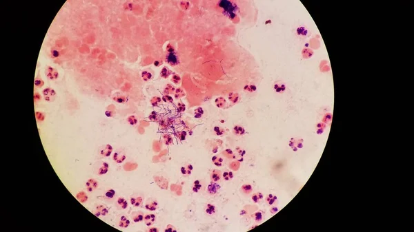 Staining Stock Photos & Royalty-Free Images | Depositphotos