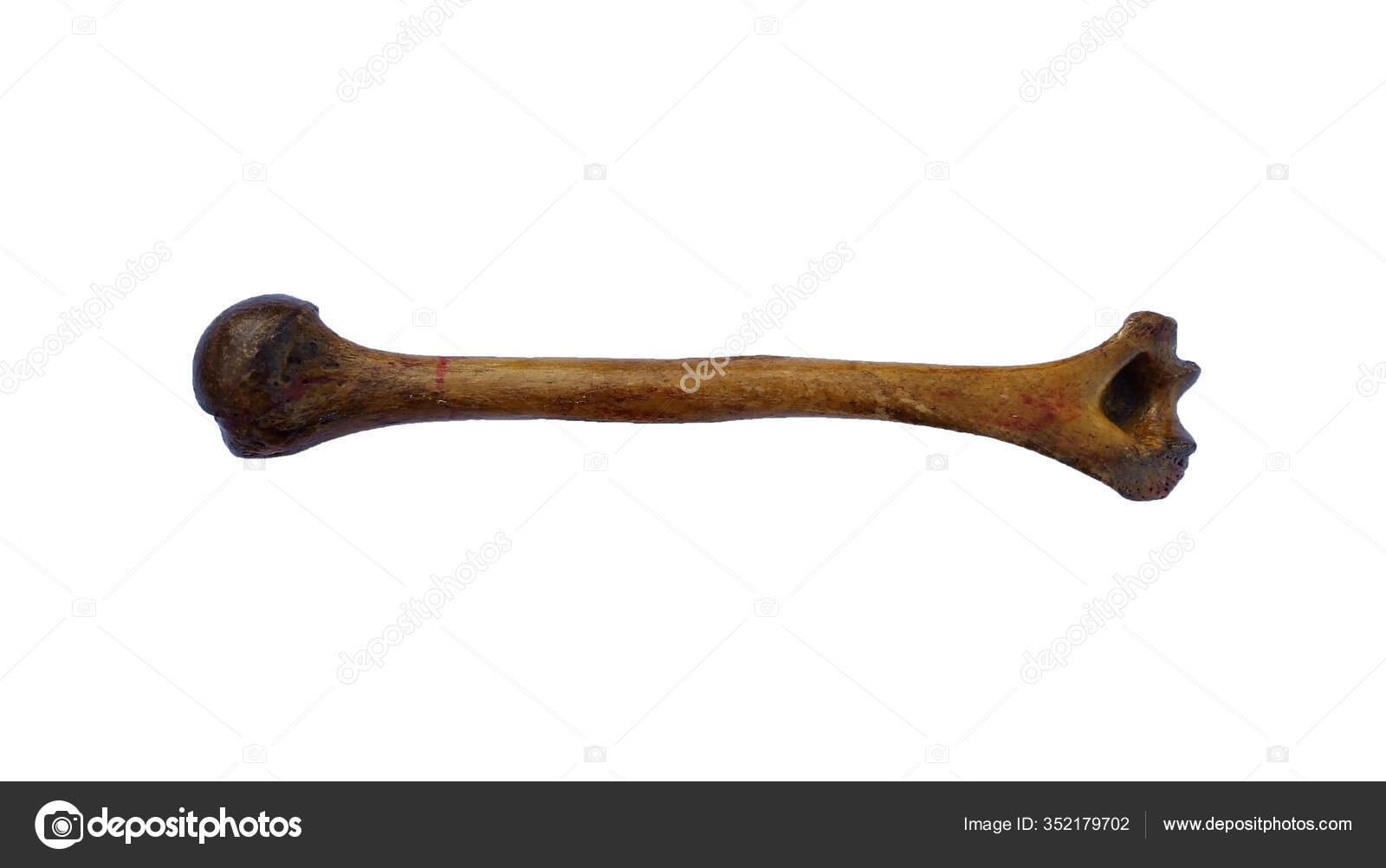 Osso Do Umero Humano