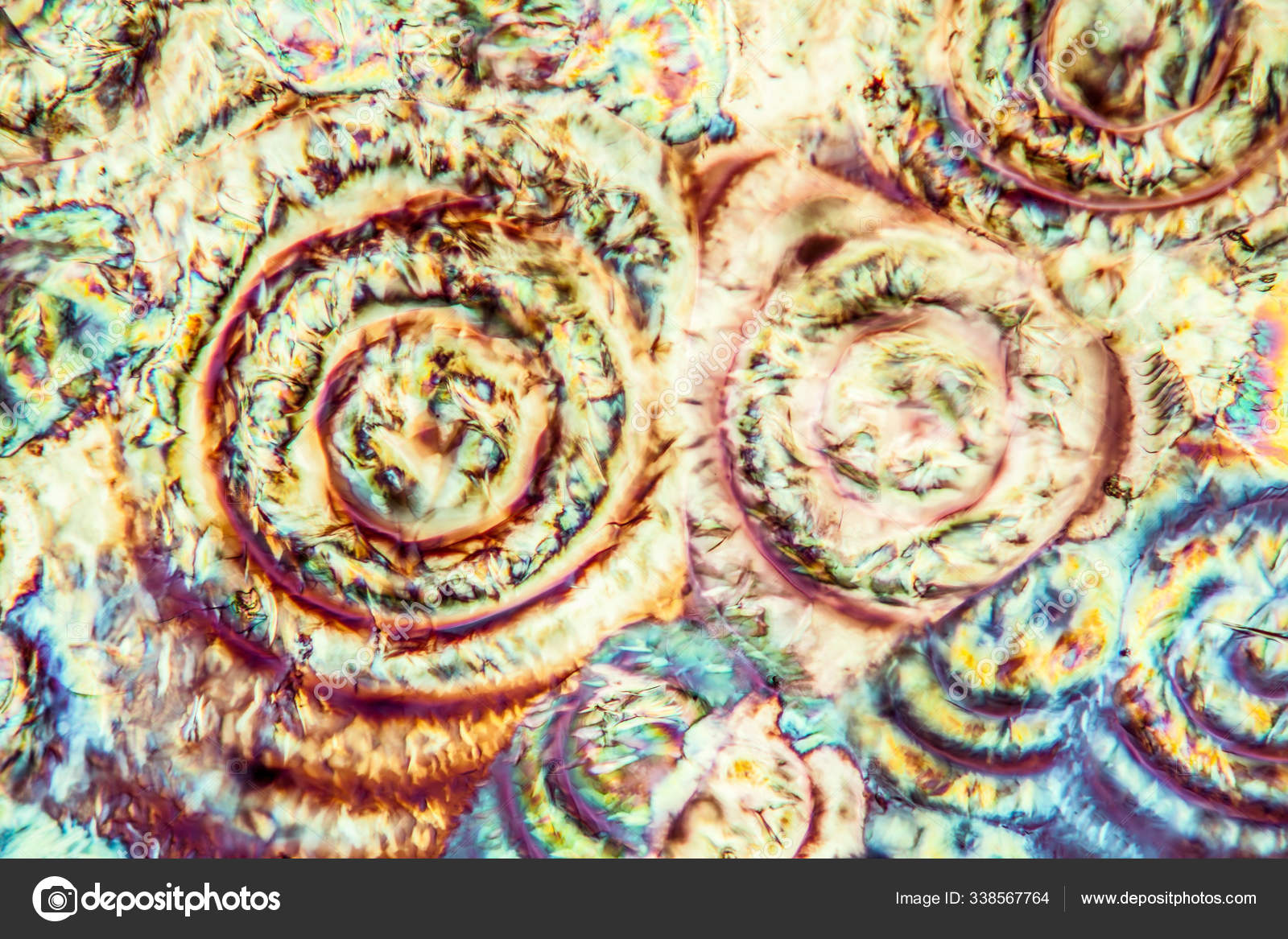 Crystals Polarized Light Microscopic Cells Texture — Stock Photo ...