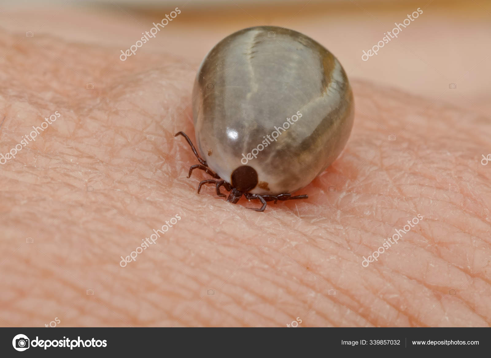 Ticks Ixodida Order Mites Acari Leathery Skin Stretchy Ren Class ⬇ ...