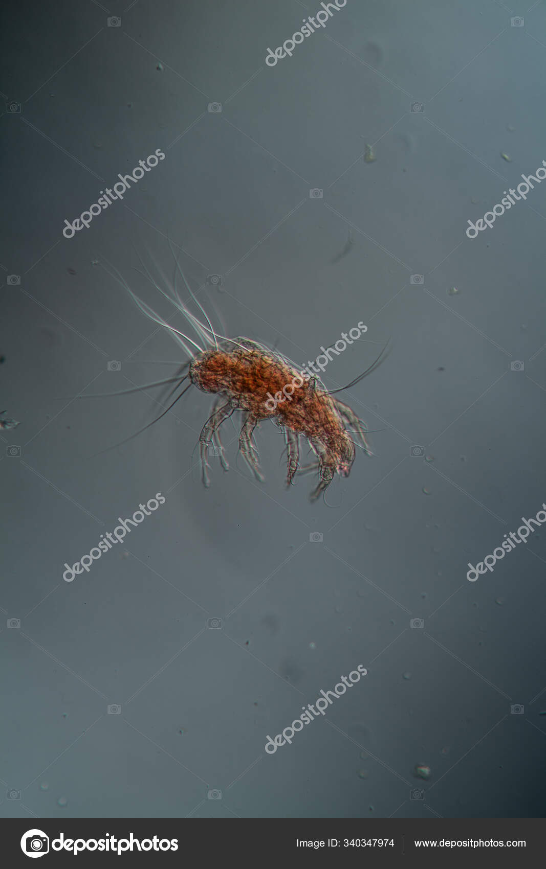 House Dust Mites Microscope 100X — Stock Photo © PantherMediaSeller ...