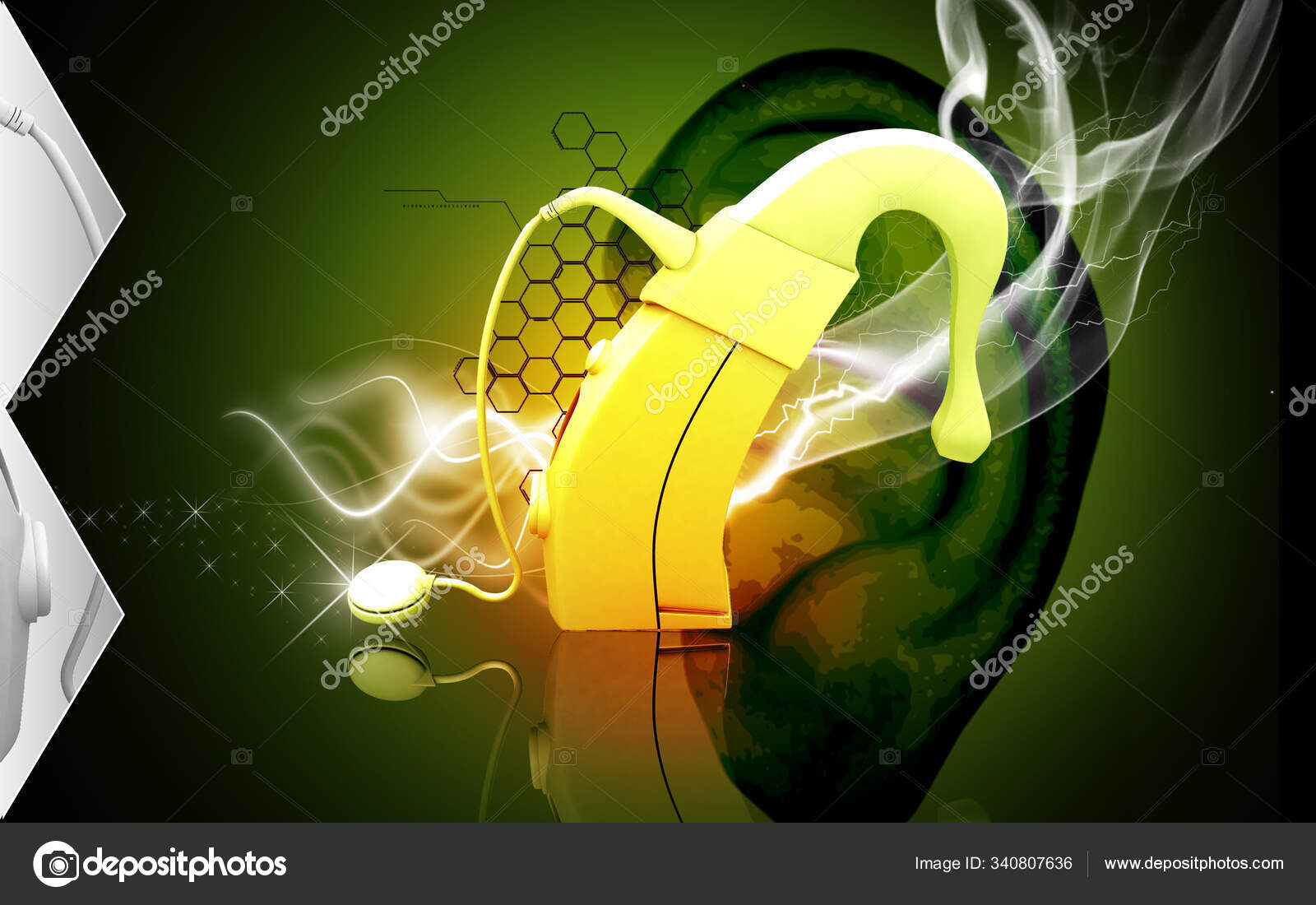 Digital Illustration Cochlear Implant Colour Background Stock Photo by ...