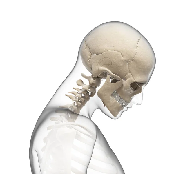 Neck fracture Stock Photos, Royalty Free Neck fracture Images ...