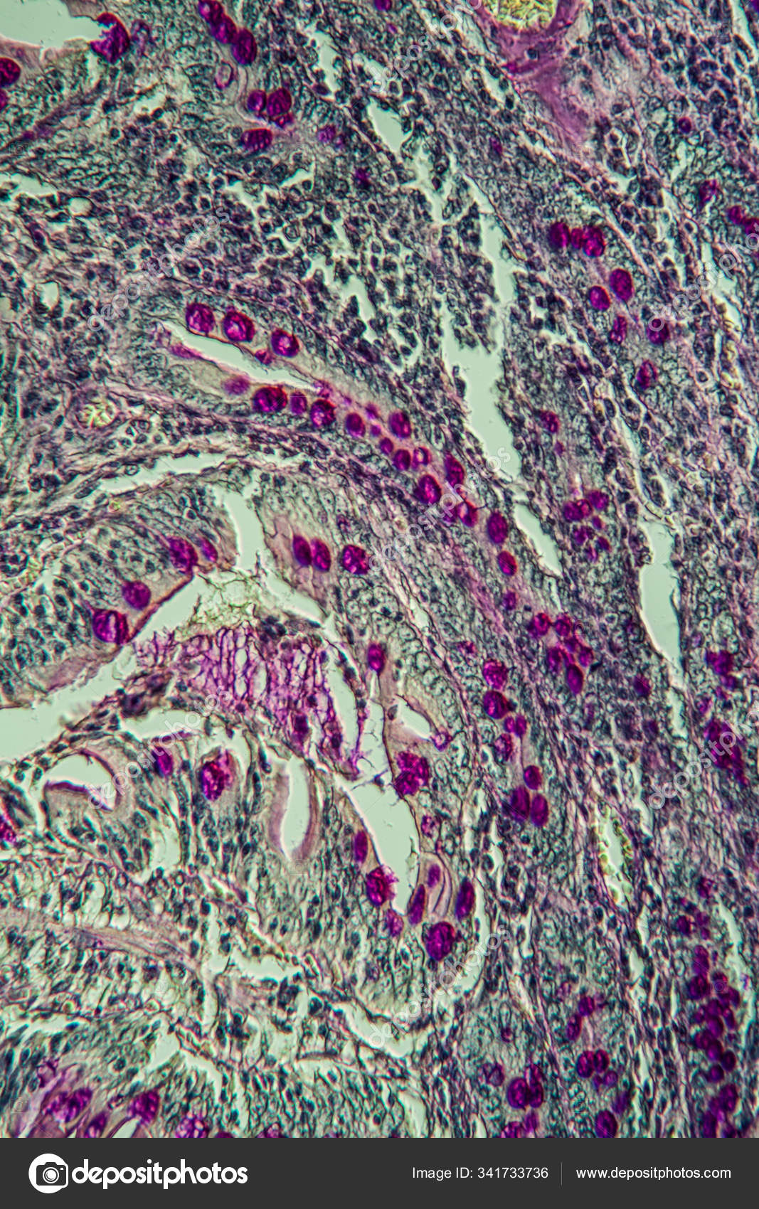 Small Intestine Pig 200X Stock Photo by ©PantherMediaSeller 341733736