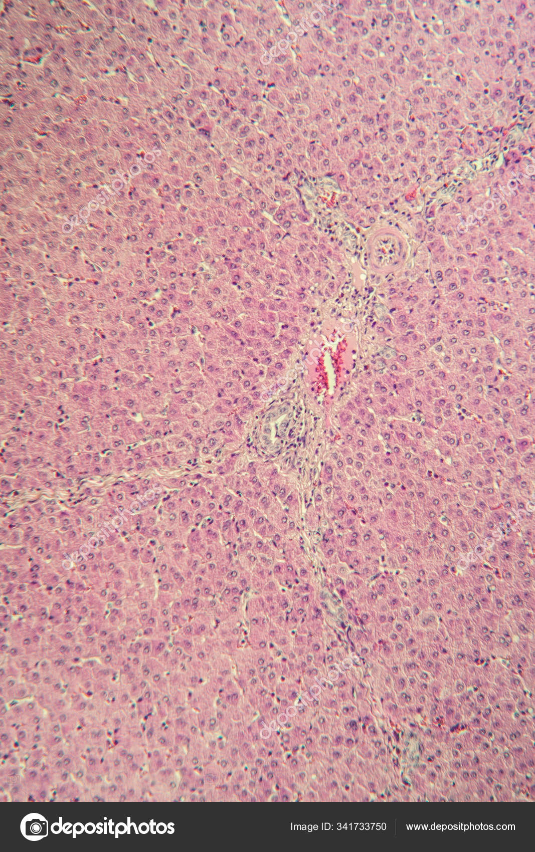 Pork Liver Cut 100X — Stock Photo © PantherMediaSeller #341733750