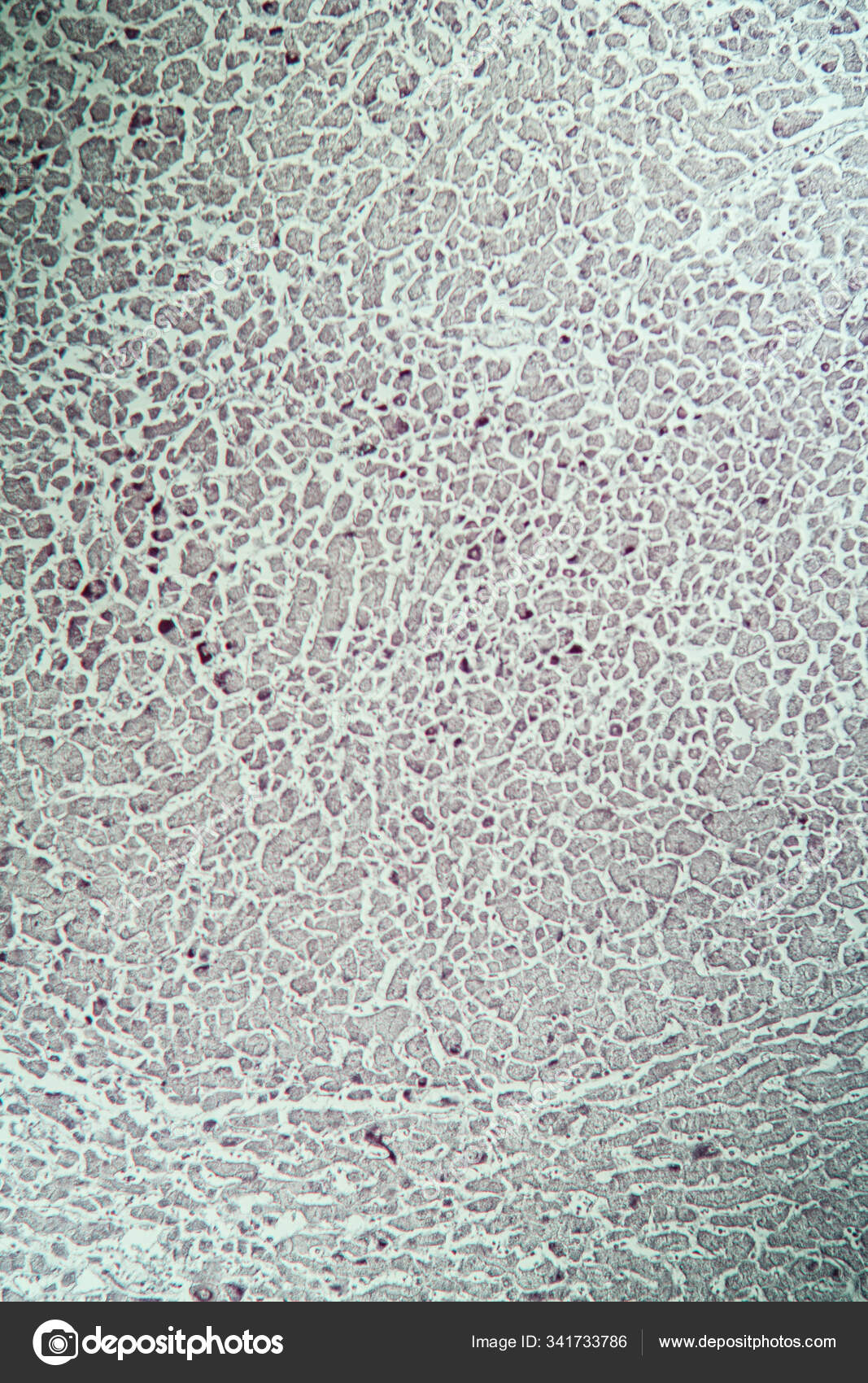 Diseased Tissue Microscope 100X — Stock Photo © PantherMediaSeller ...