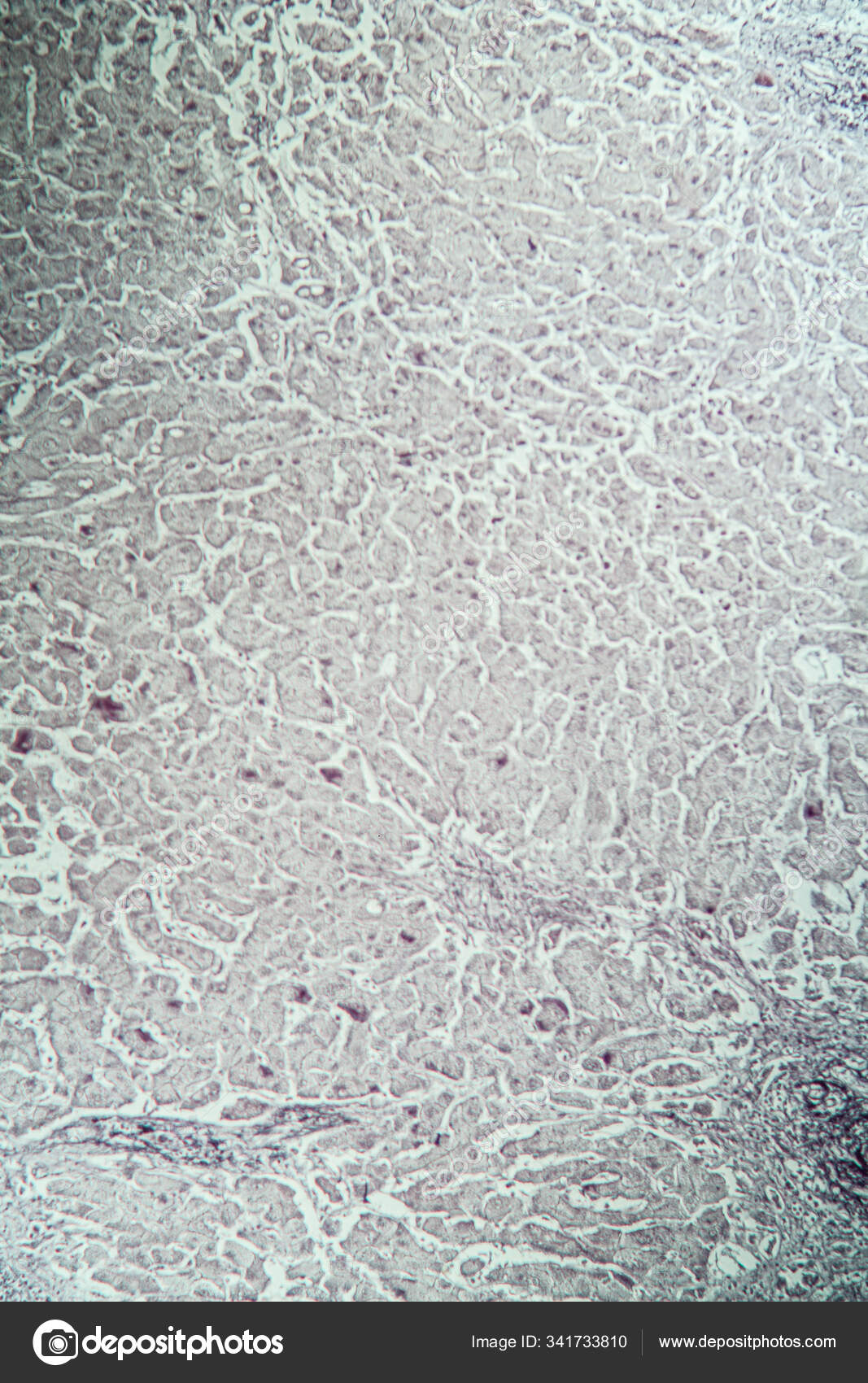 Diseased Tissue Microscope 100X — Stock Photo © PantherMediaSeller ...