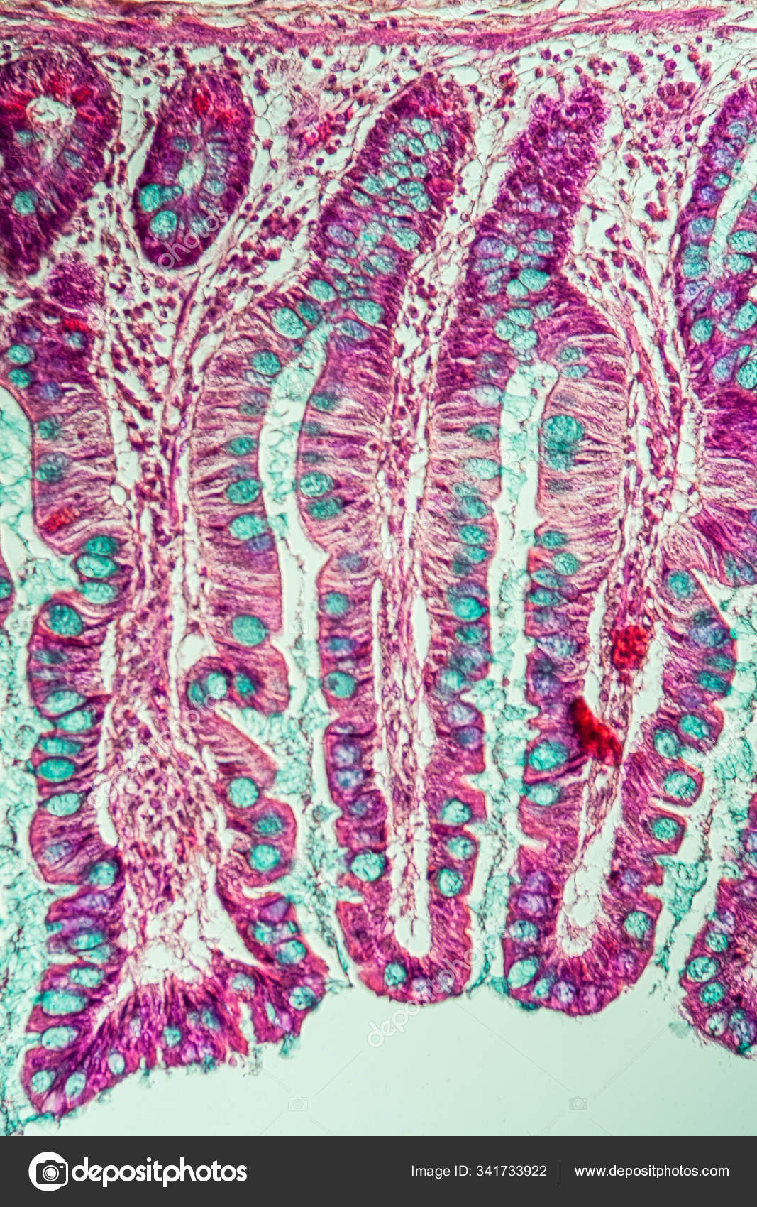 Small Intestine Intestinal Villi Microscope 200X Stock Photo by ...