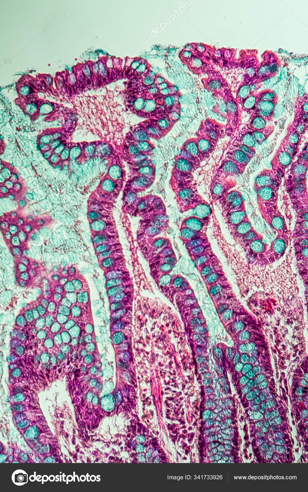 Intestin Grêle Avec Villosités Intestinales Microscope 200X image libre ...