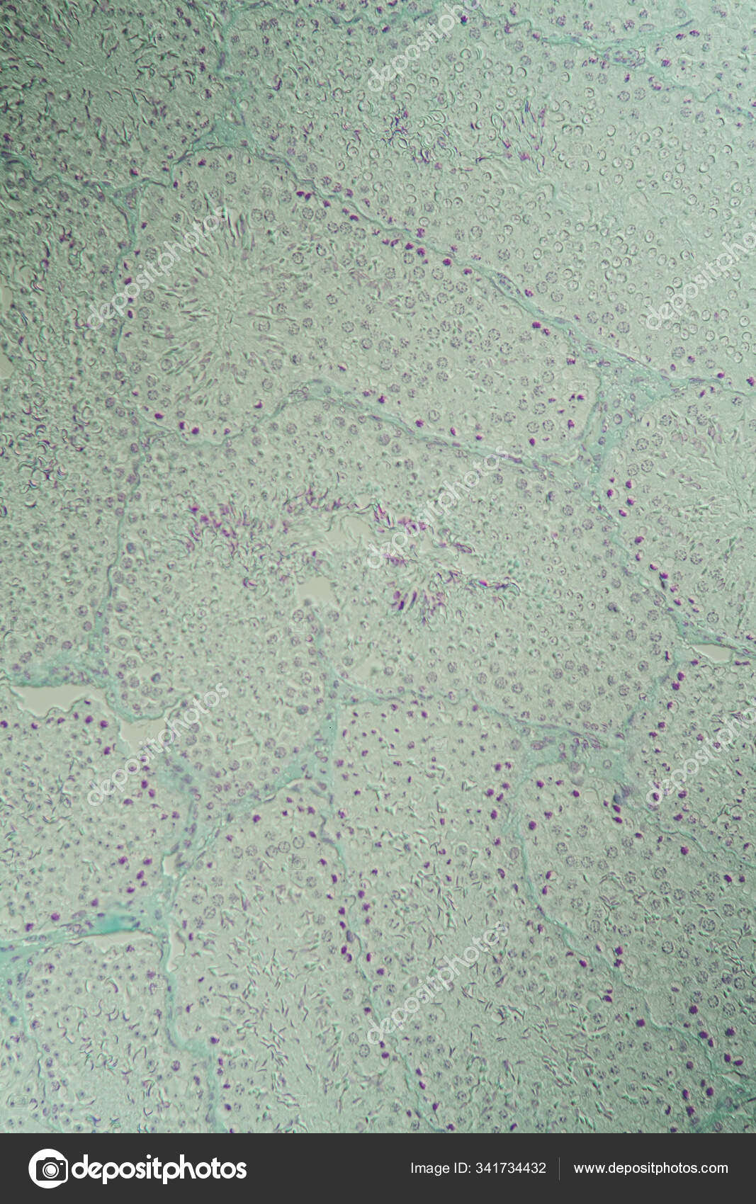 Testicles Guinea Pig Microscope — Stock Photo © PantherMediaSeller ...