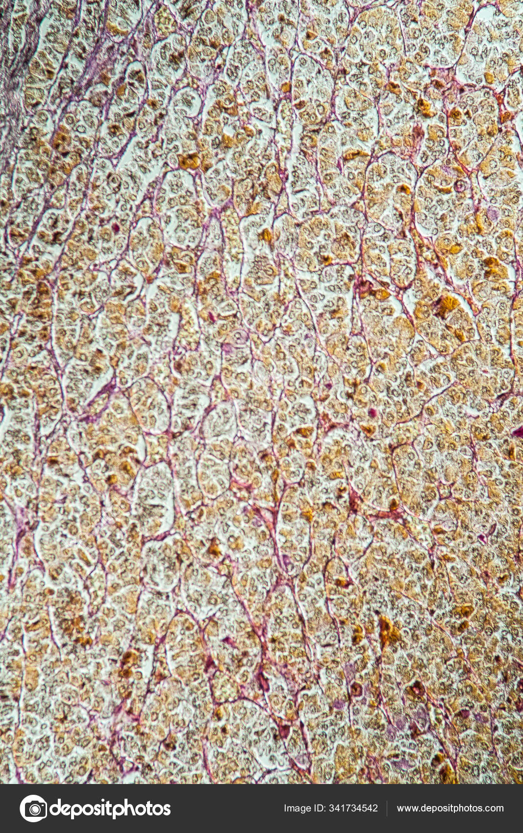 Pituitary Gland Microscope Stock Photo by ©PantherMediaSeller 341734542