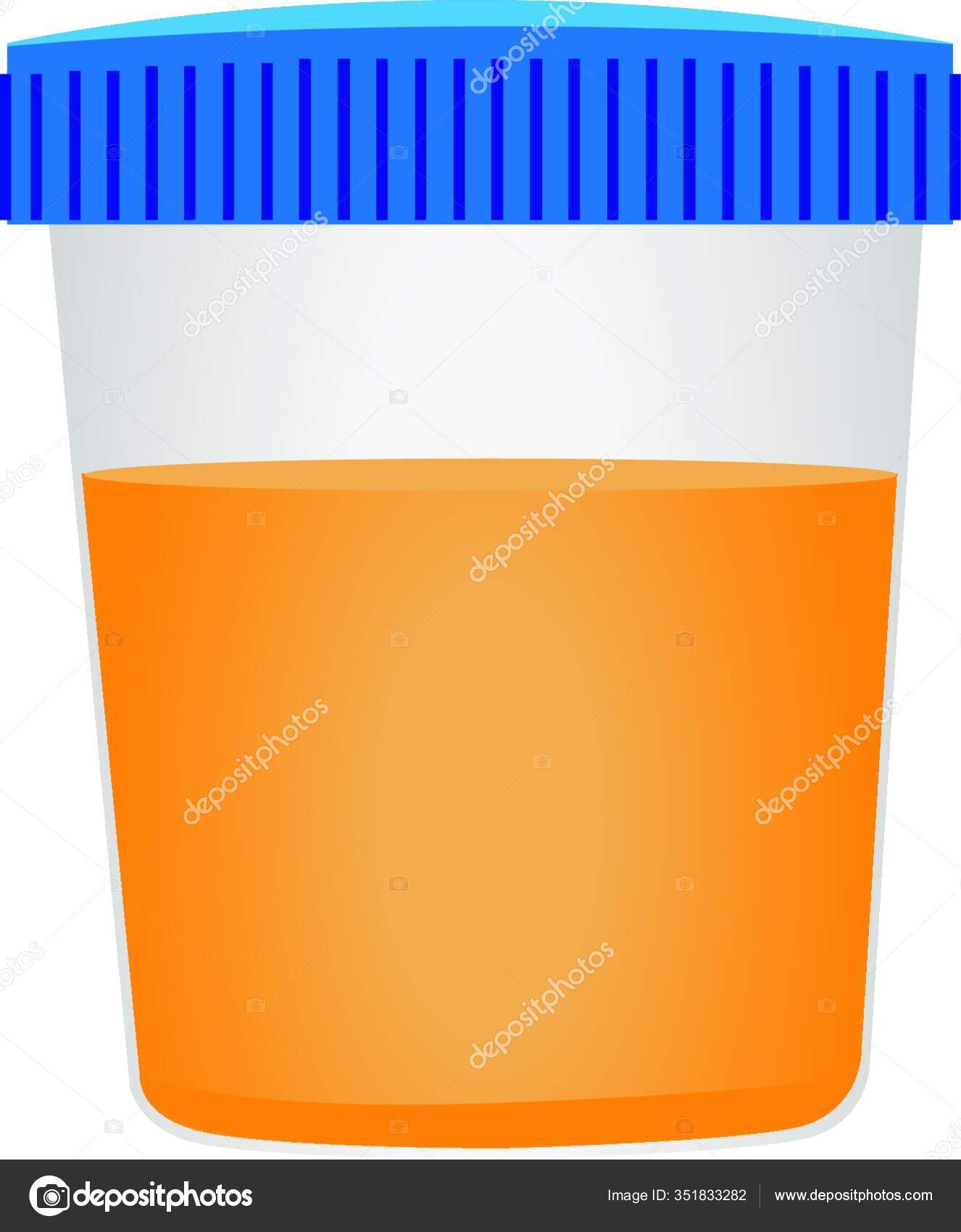 Urine Alysis Medical Test Biological Examination Lab Stock Vector by ...