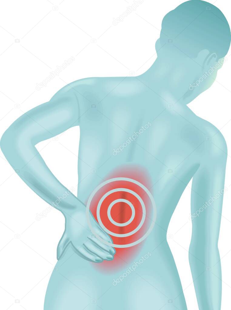 ilustración médica de los síntomas del dolor de espalda 2022