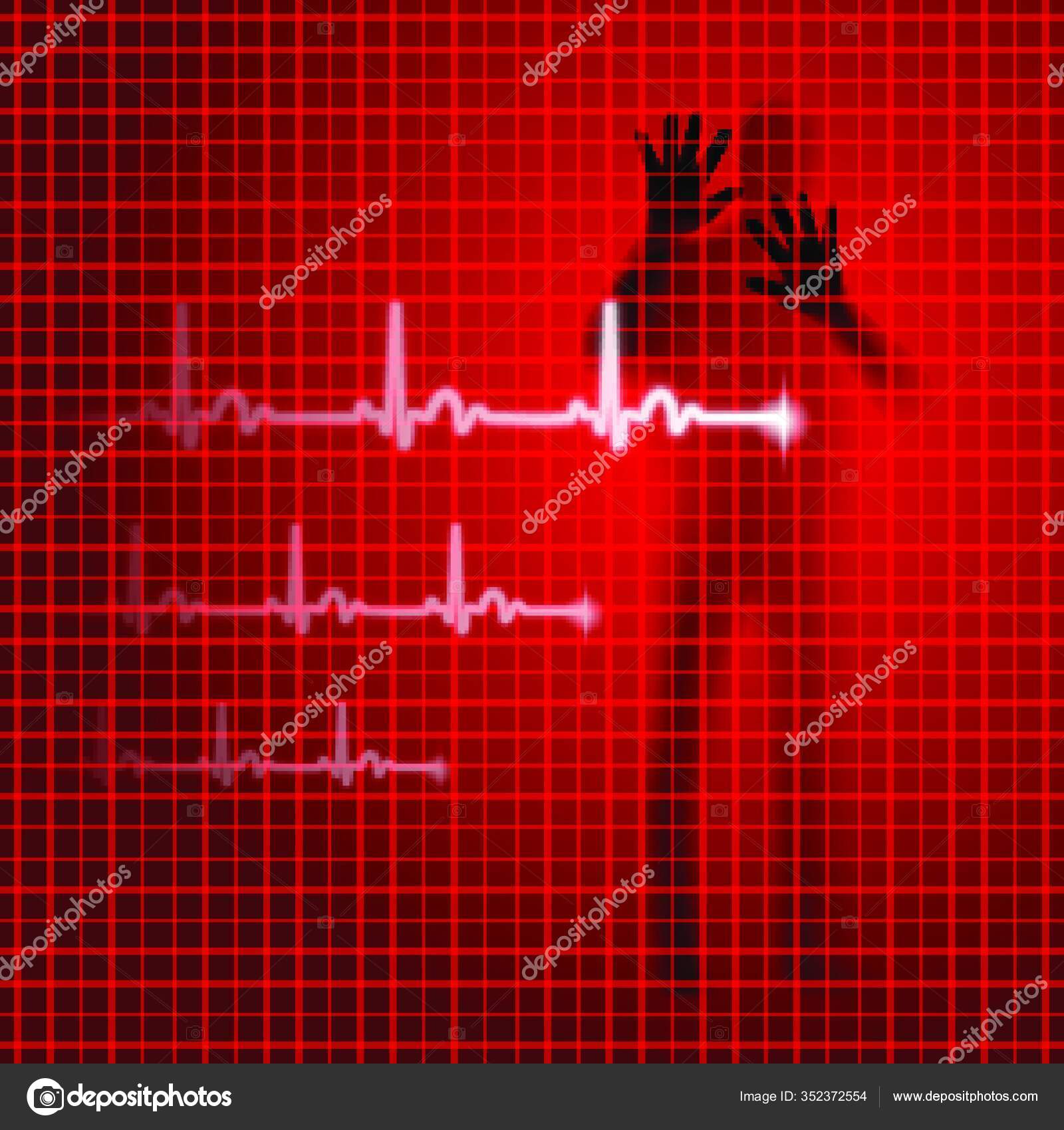 Red Medical Background Human Silhouette Cardiogram Line Stock Vector by ...