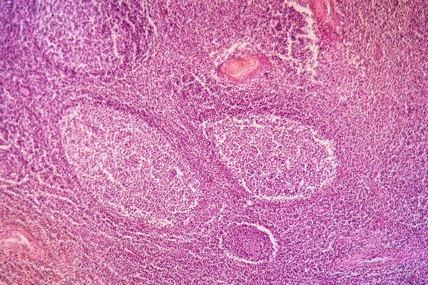 Rupture of membrane Stock Photos, Royalty Free Rupture of membrane ...