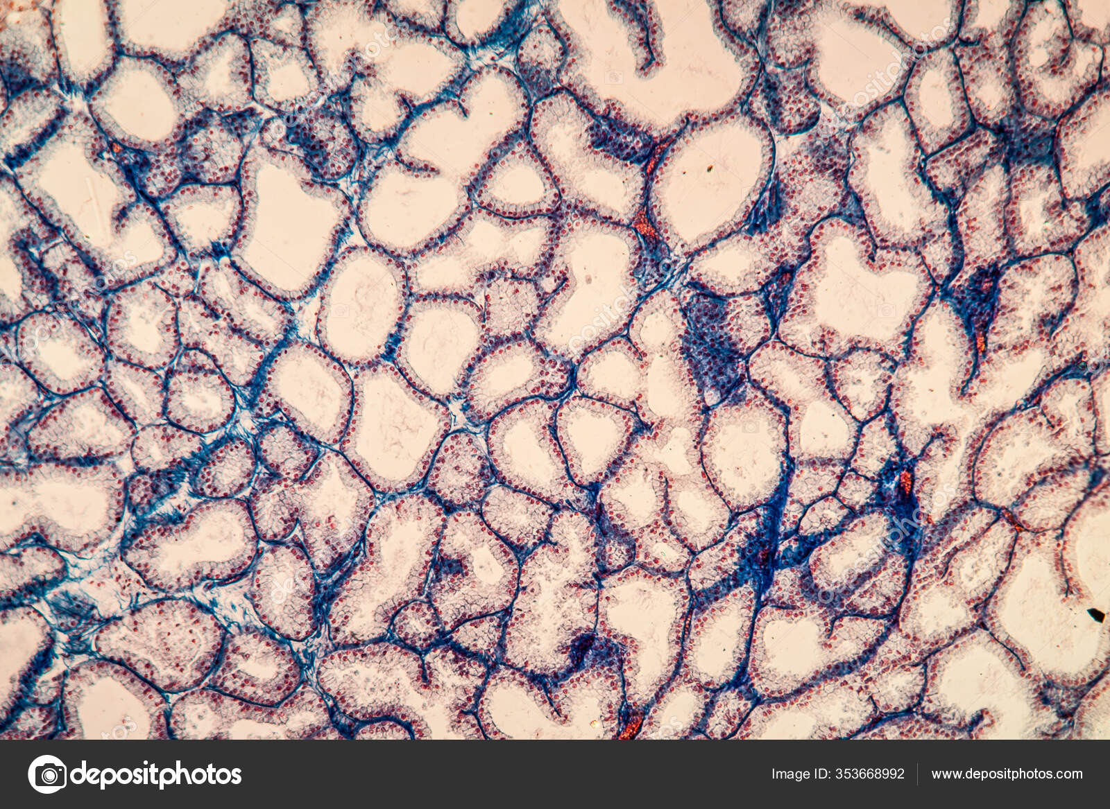 Tear Gland Tissue Microscope 100X Stock Photo by ©PantherMediaSeller ...