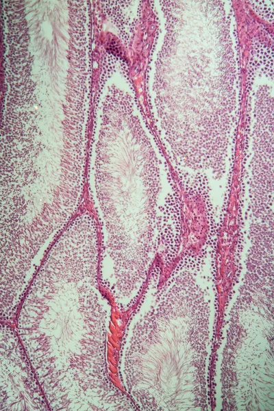 Intestino detalle Stock Photos, Royalty Free Intestino detalle Images ...