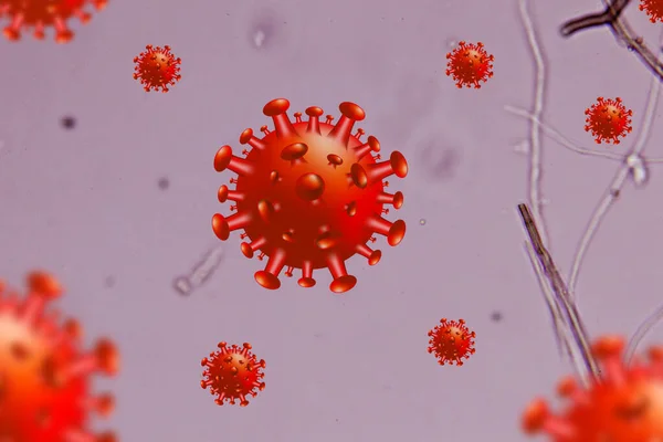 Corona virus disease COVID-19 infection, medical illustration. New ...