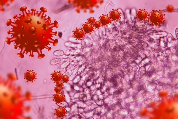 Corona virus disease COVID-19 infection, medical illustration. New ...