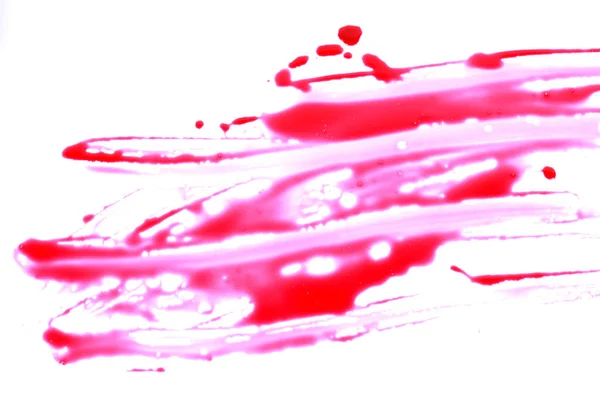 Capillary hemorrhage Stock Photos, Royalty Free Capillary hemorrhage ...