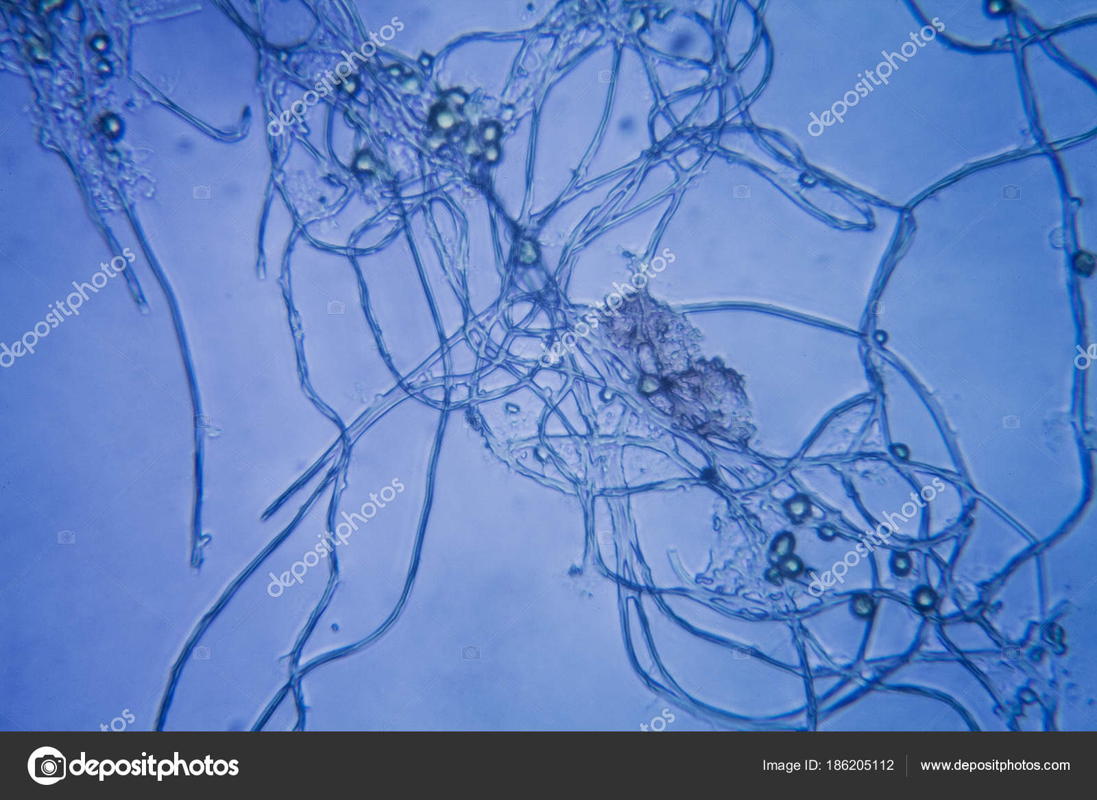 Mold Under Microscope