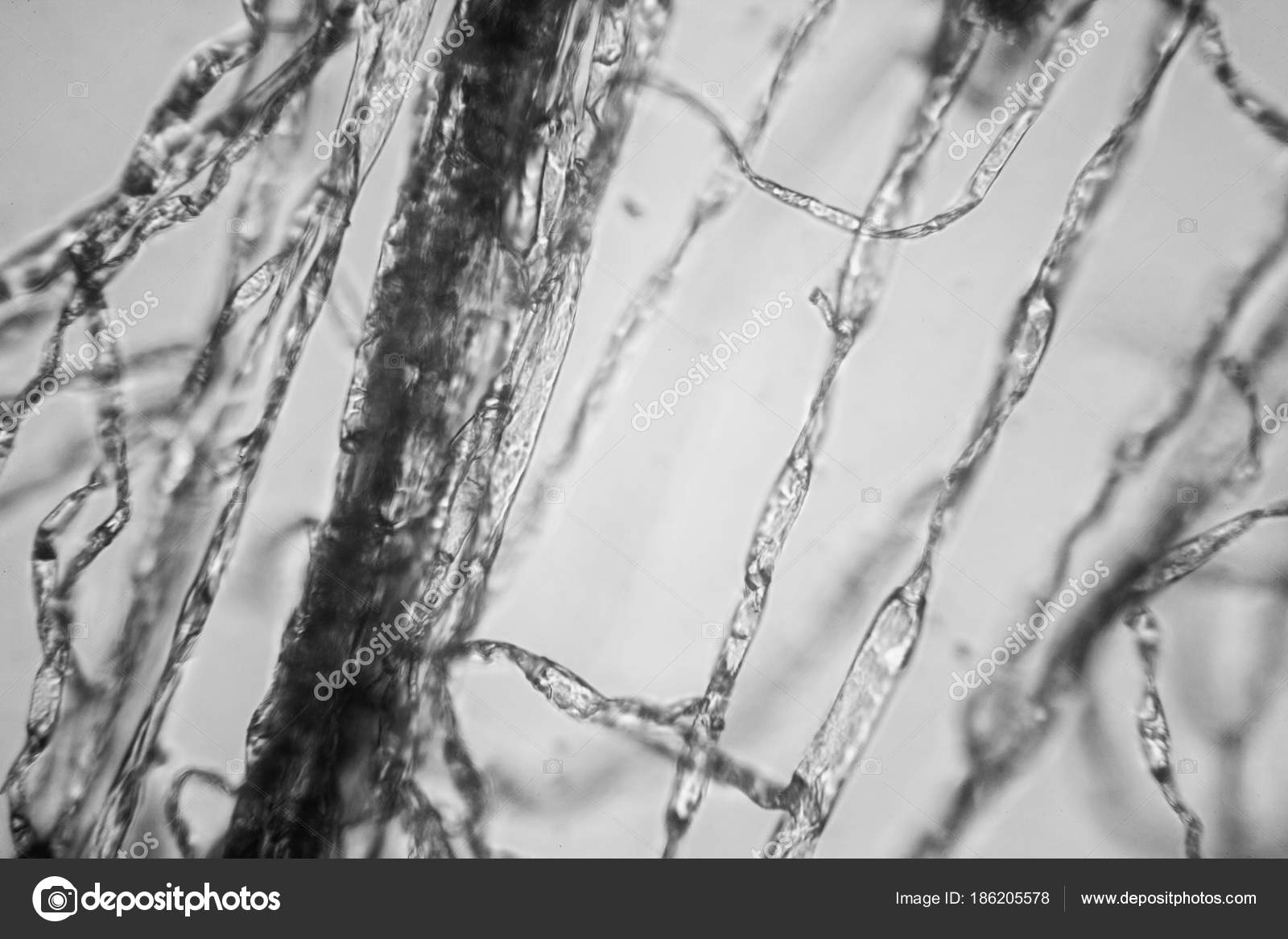 Water Molds Microscope