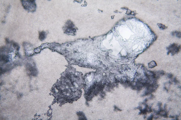 Mold microscope Stock Photos, Royalty Free Mold microscope Images ...