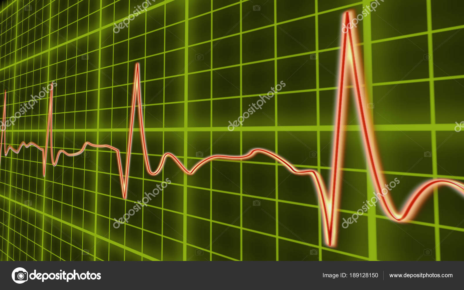 Heart Rate Line Graph