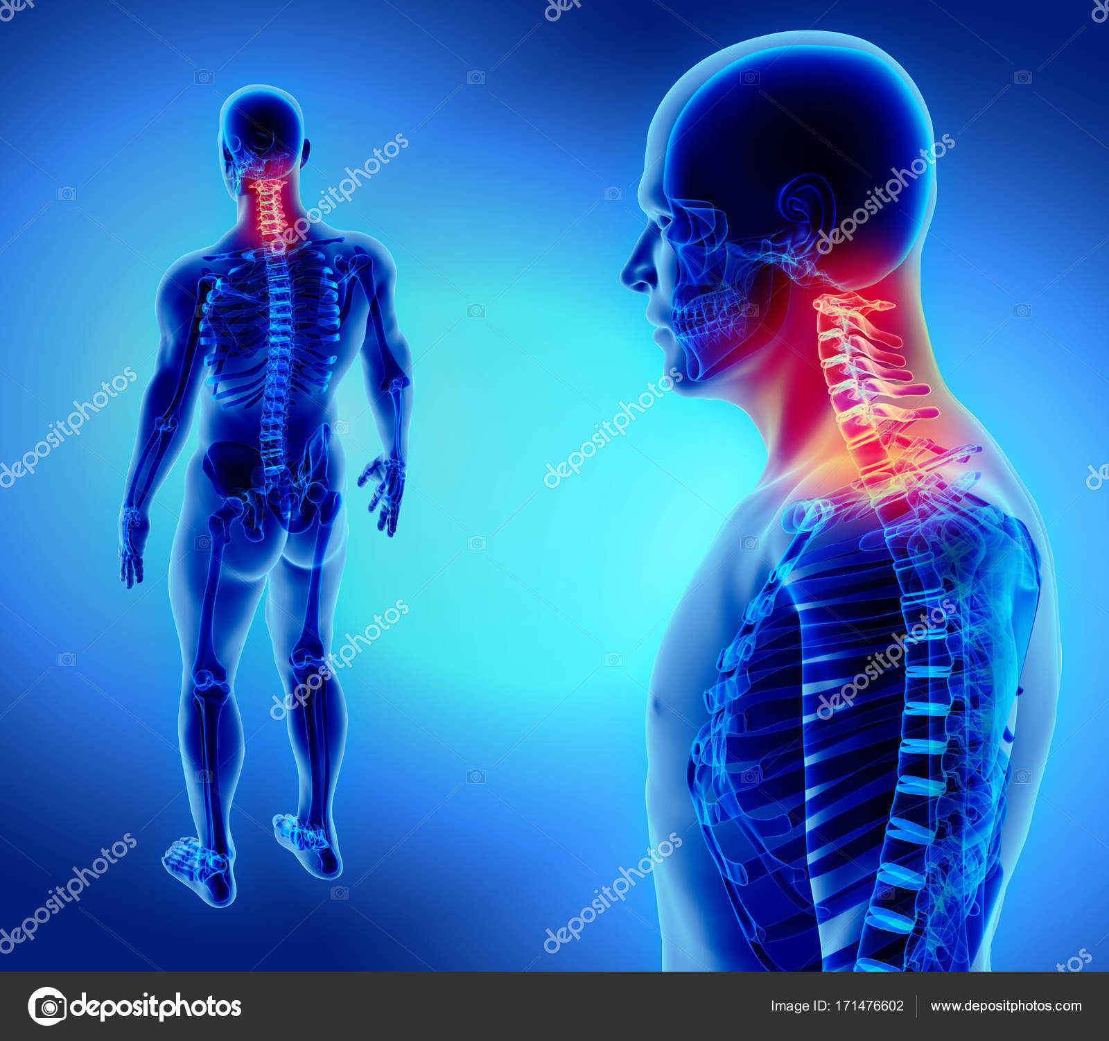 Ilustração 3D da coluna cervical, conceito médico . — Fotografia de ...