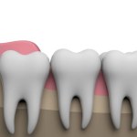 Wisdom Tooth Horizontal Rendering White Background Stock Photo by ...