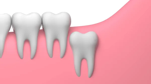 Wisdom Tooth Horizontal Rendering White Background Stock Photo by ...