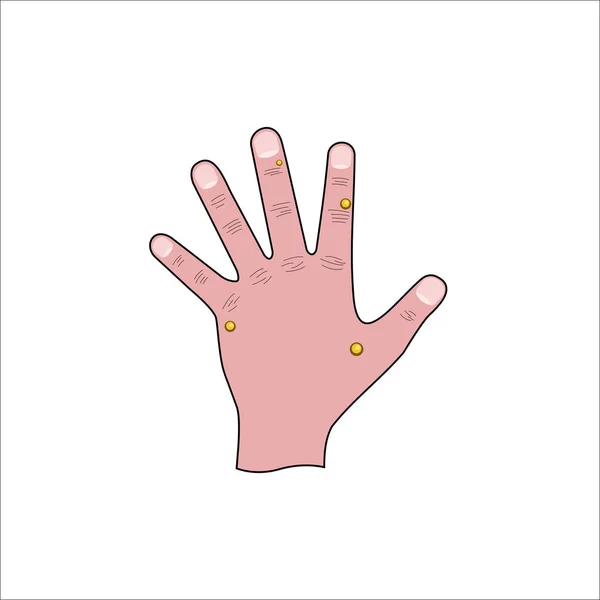 Wart icon Vector Art Stock Images | Depositphotos