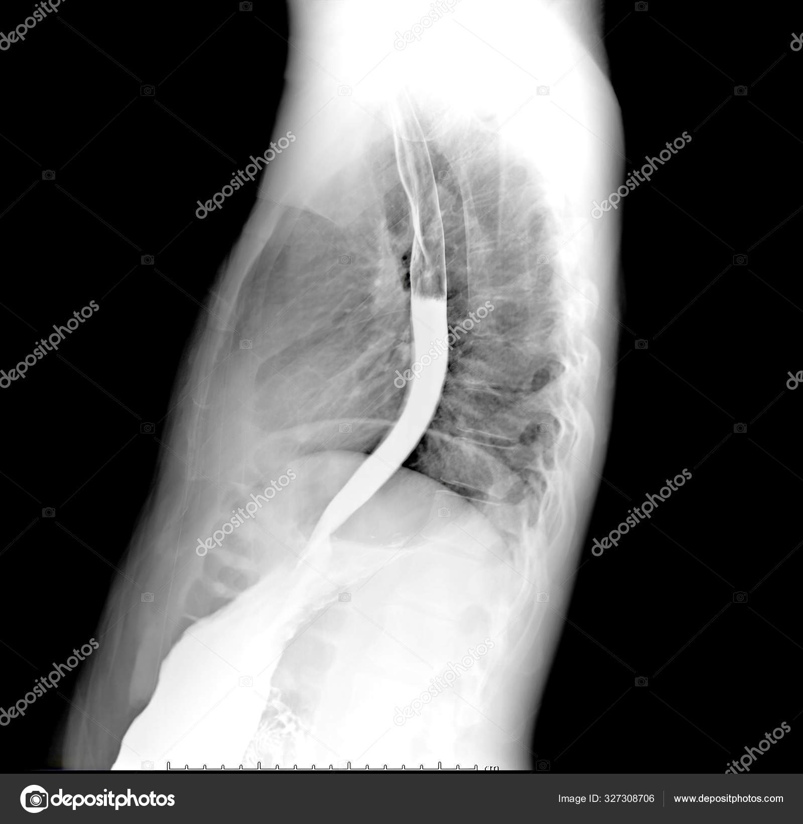 Esophagram — Stock Photo © samunella #327308706
