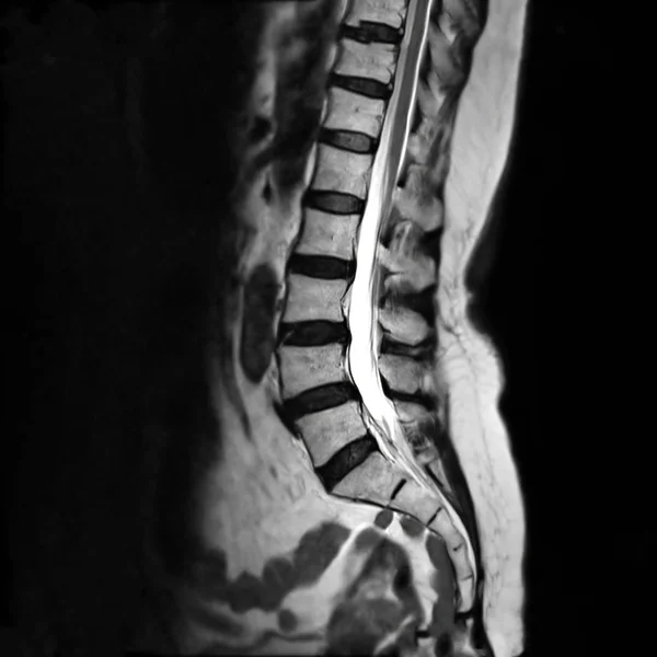 Mri spine Stock Photos, Royalty Free Mri spine Images | Depositphotos