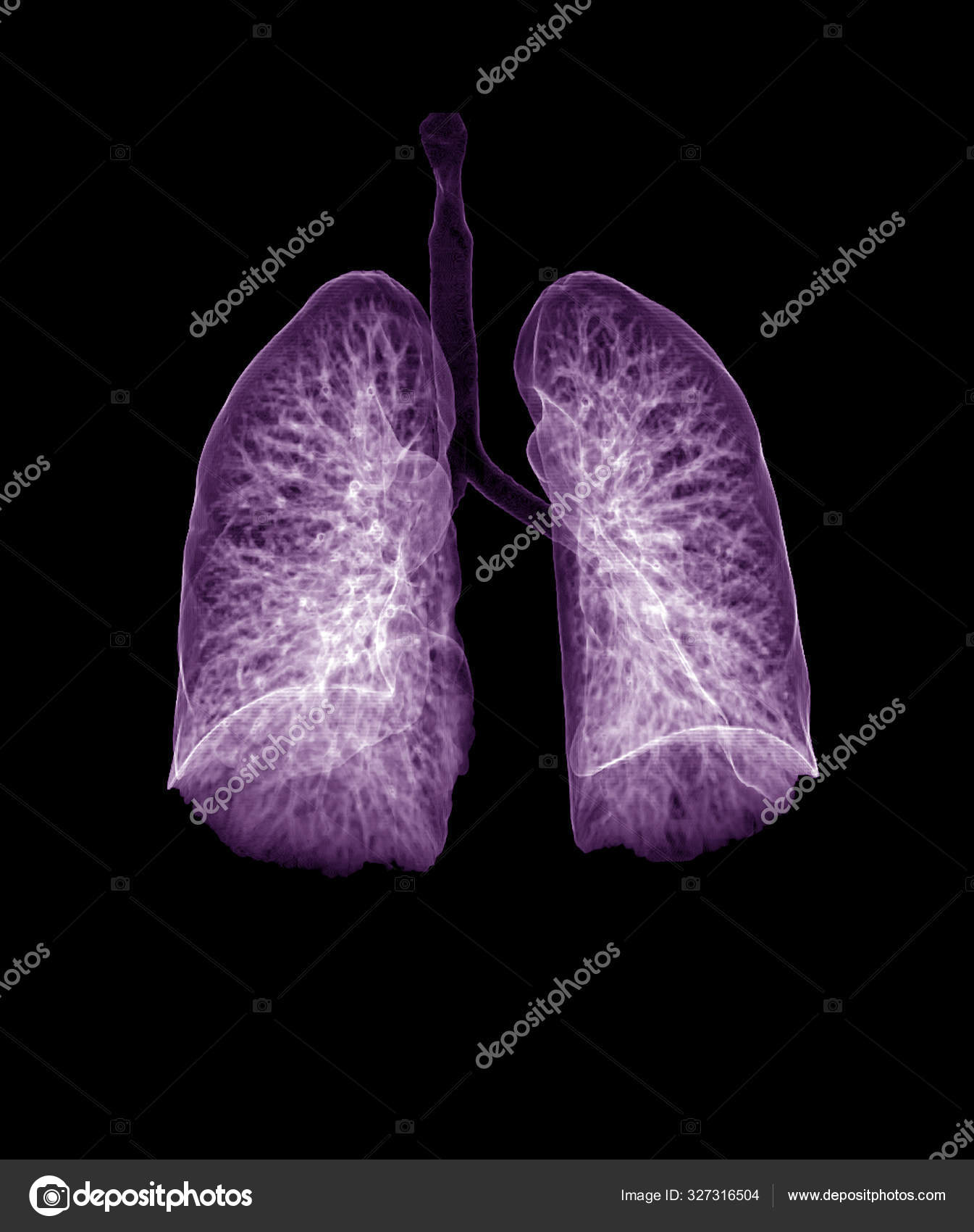 Chest Lung Rendering Image Purple Color Showing Trachea Lung ...