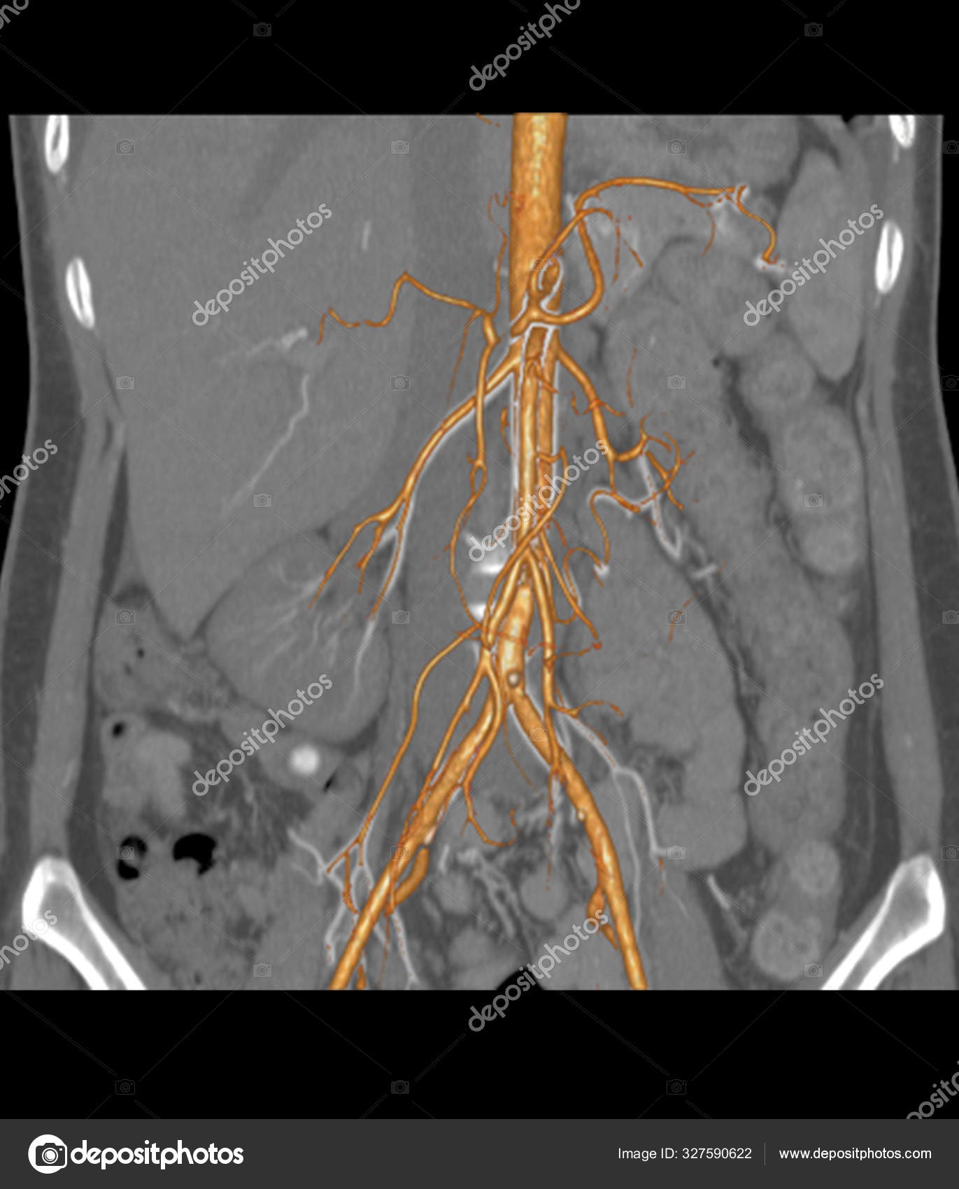 Close Scanner Red Laser Beam Adjust Position Clipping Path Stock Photo ...