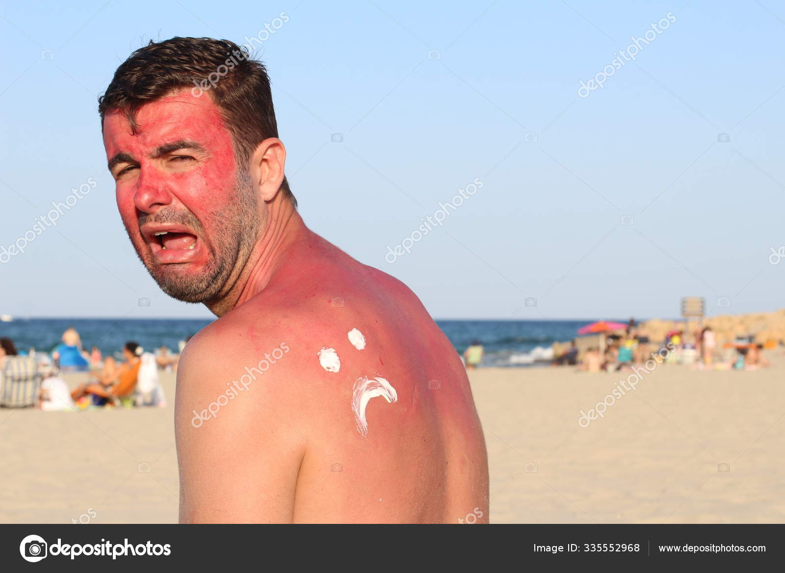 Man Getting Sunburned Beach — Stock Photo © albejor2002@hotmail.com ...