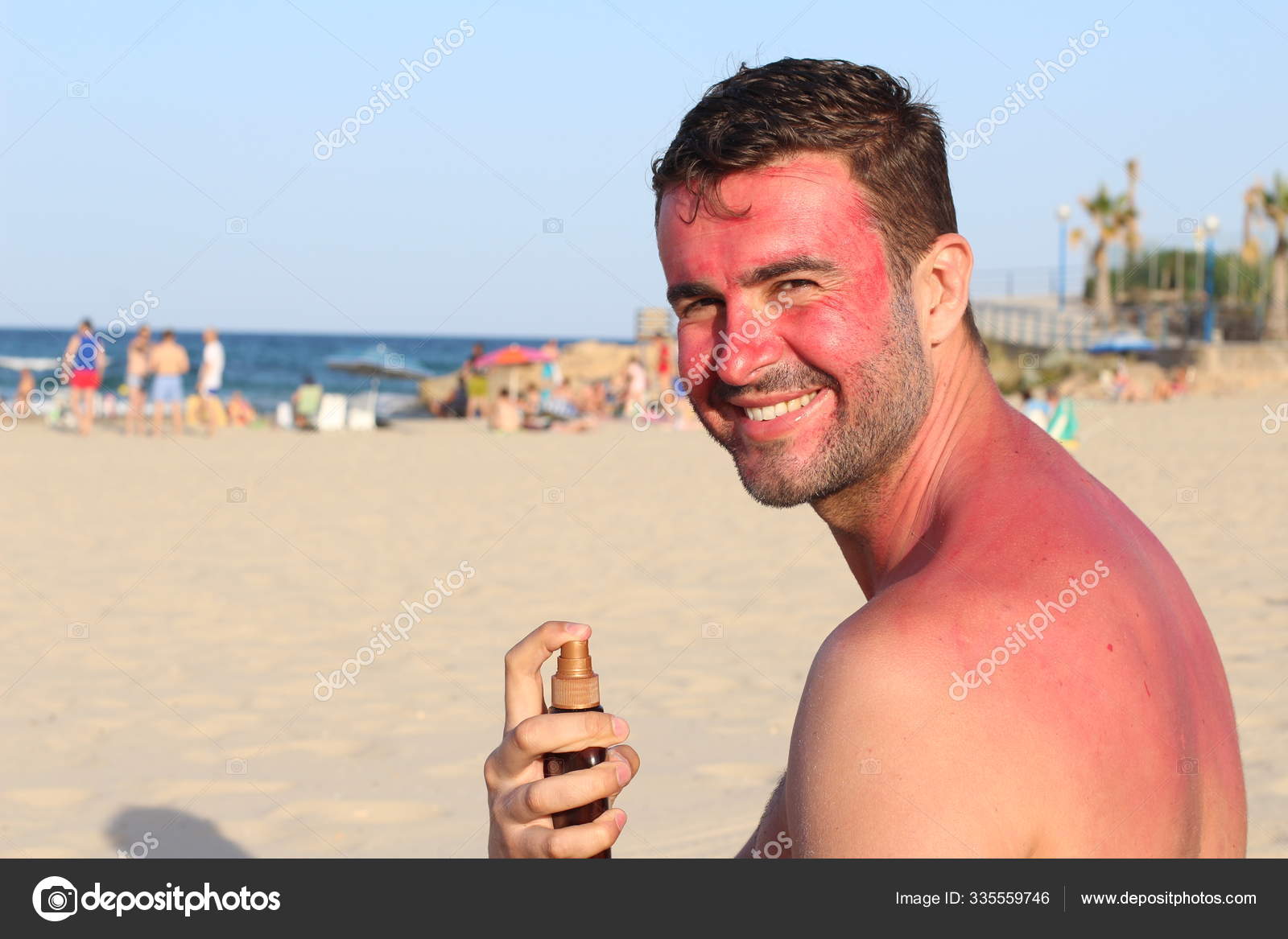 Man Getting Sunburned Beach — Stock Photo © albejor2002@hotmail.com ...