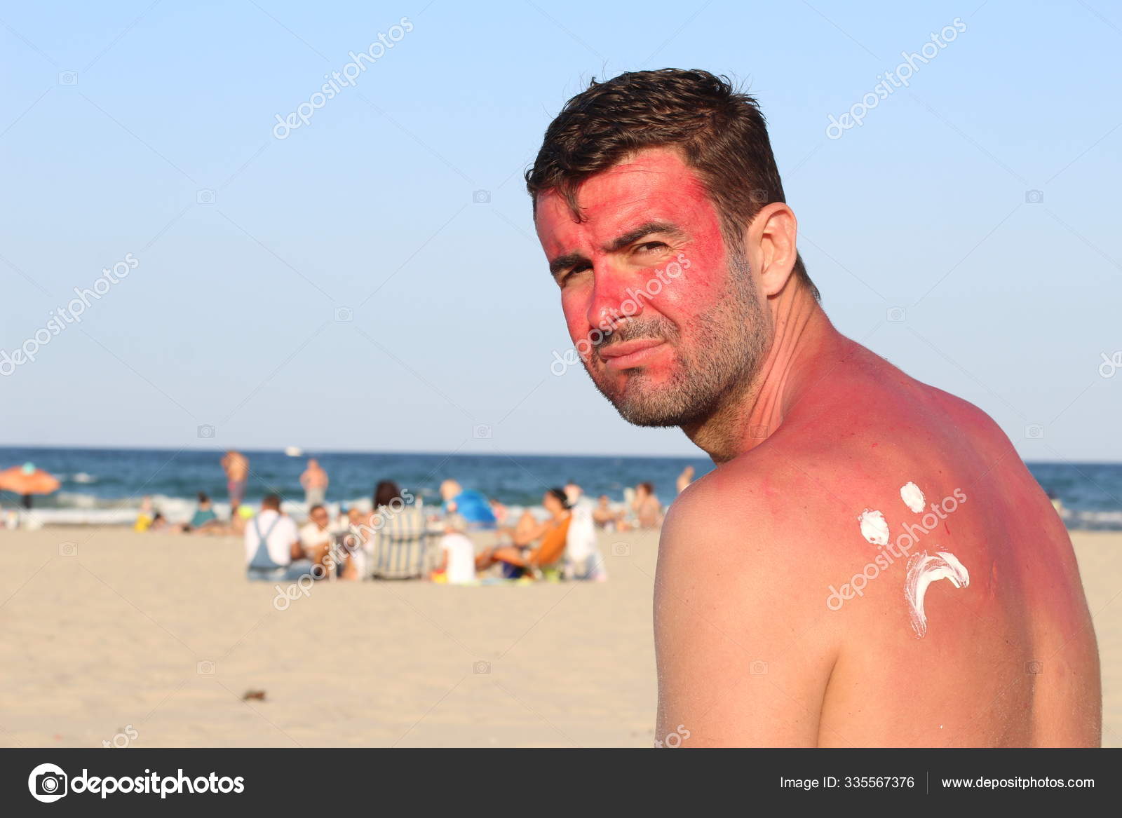 Man Getting Sunburned Beach — Stock Photo © albejor2002@hotmail.com ...